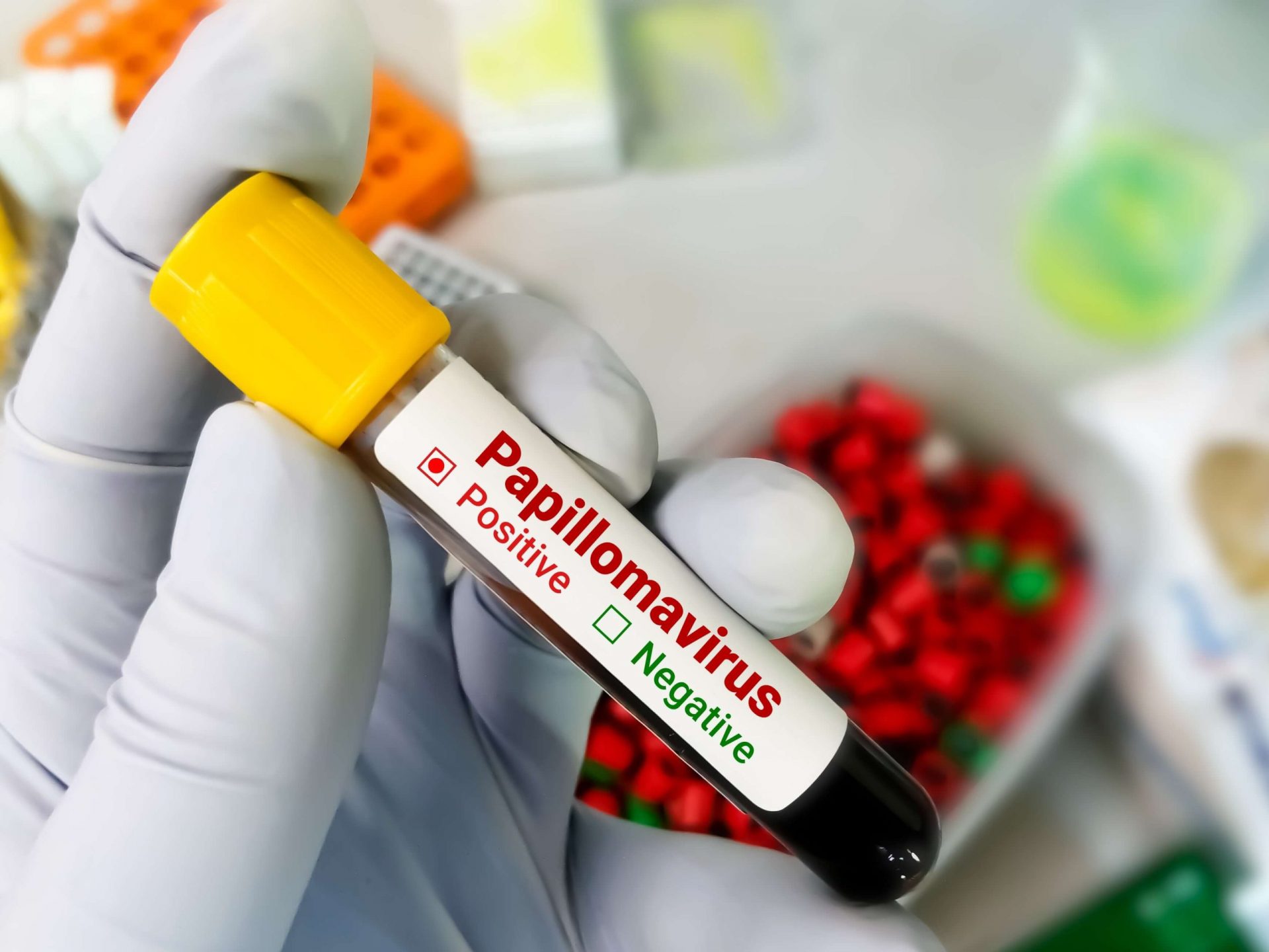 ¿Qué es el VPH y todo lo que debes saber sobre esta infección ...